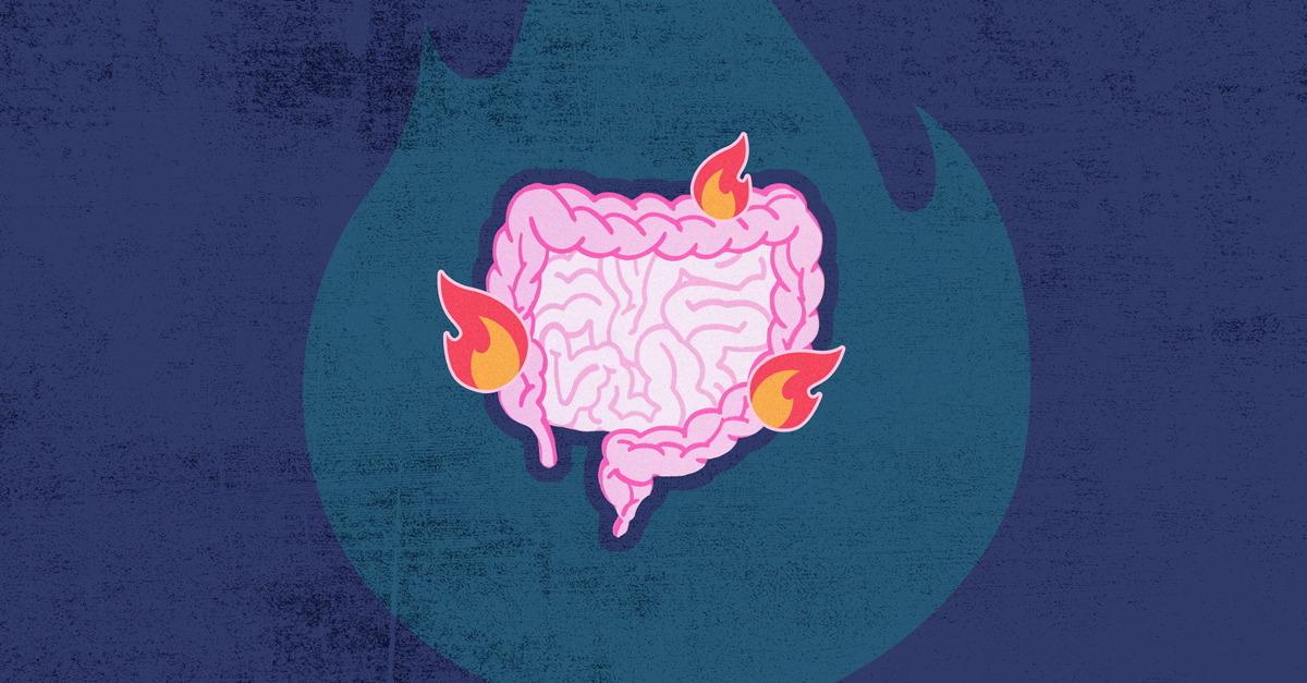 Get the Proper Diagnosis and Treatment for IBD